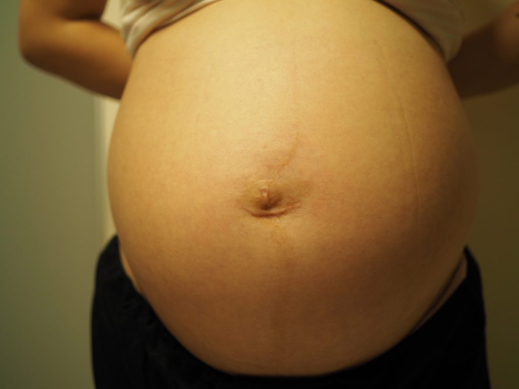 三つ子 妊娠22週【22w2d】のおなか&妊婦検診【22w3d】 三つ子とかーちゃんと、時々、とーちゃん